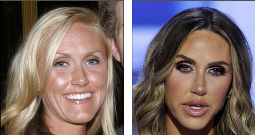 Botox, Fillers, and Politics: The Rise of Trumpland’s Signature Look ...